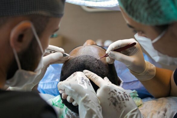 The Complete Guide to Scalp Micropigmentation in the UK: Costs, Clinics ...