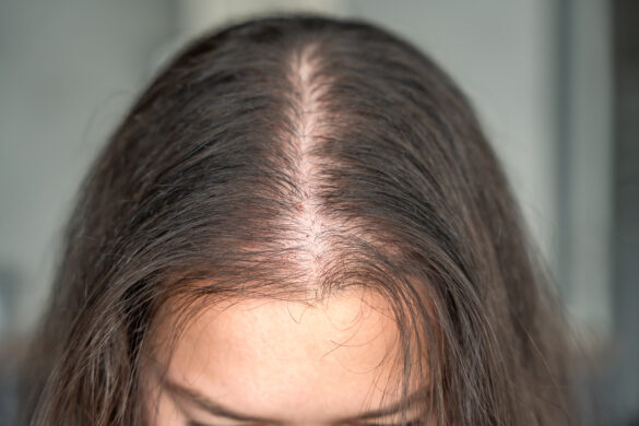 The Complete Guide to Scalp Micropigmentation in the UK: Costs, Clinics ...